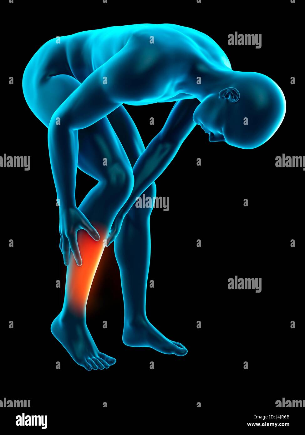 Human calf pain hi-res stock photography and images - Alamy