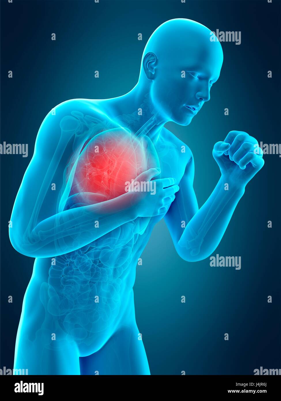 Anatomy of person coughing, illustration Stock Photo - Alamy