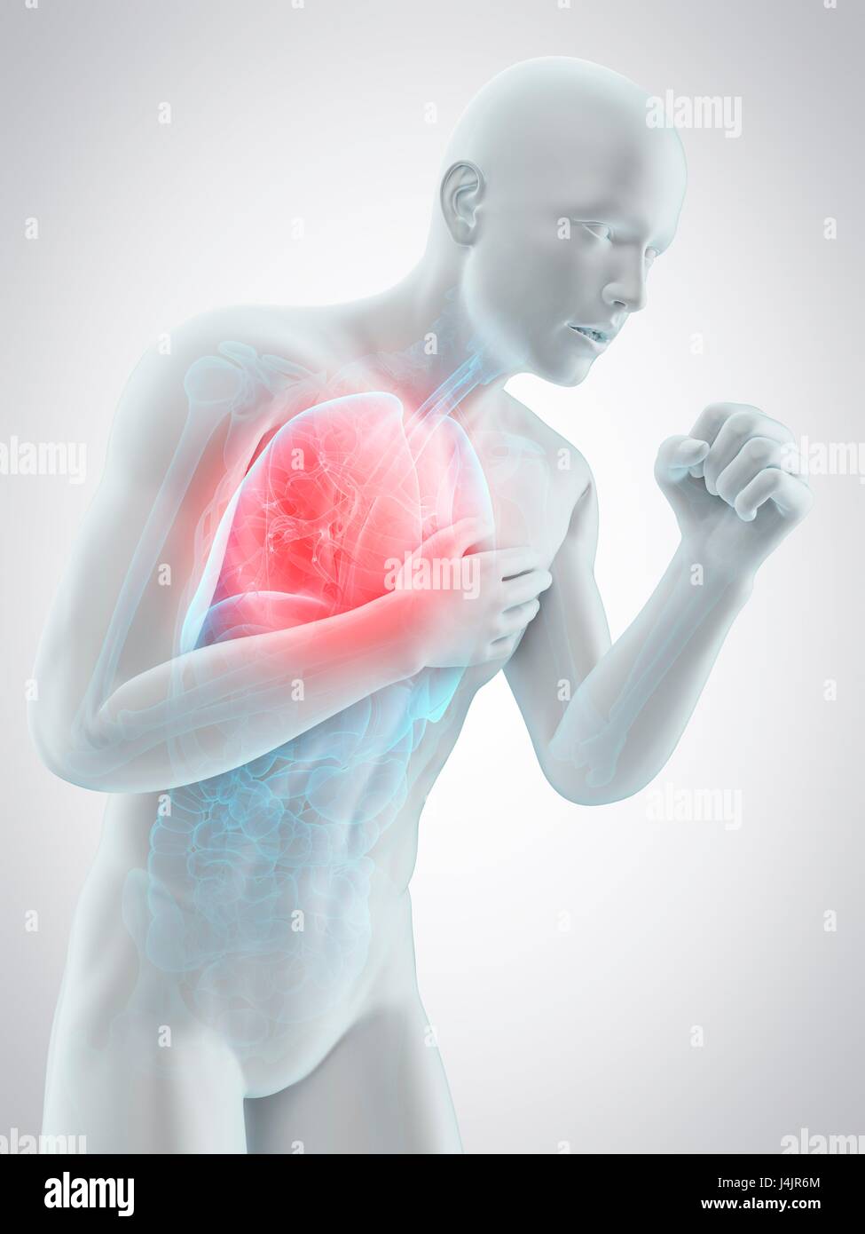 Person coughing, illustration Stock Photo - Alamy