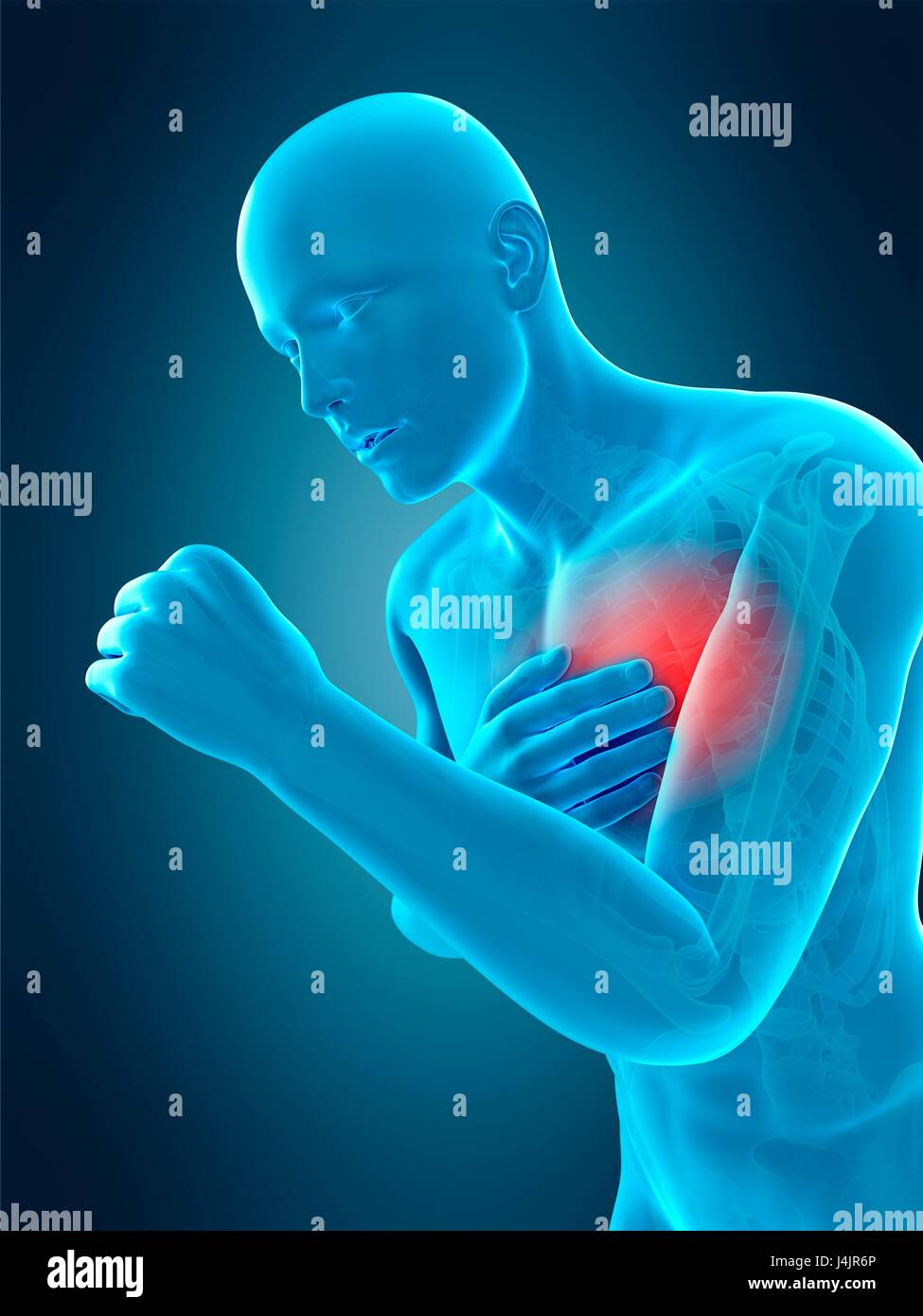Coughing illustration hi-res stock photography and images - Alamy