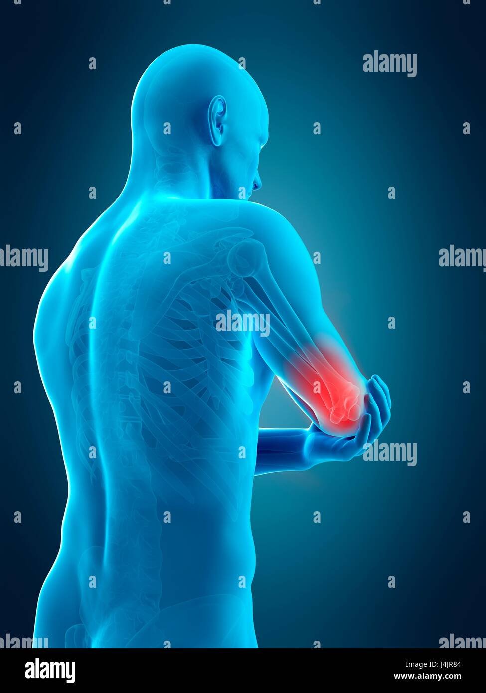 Human elbow pain, illustration Stock Photo - Alamy