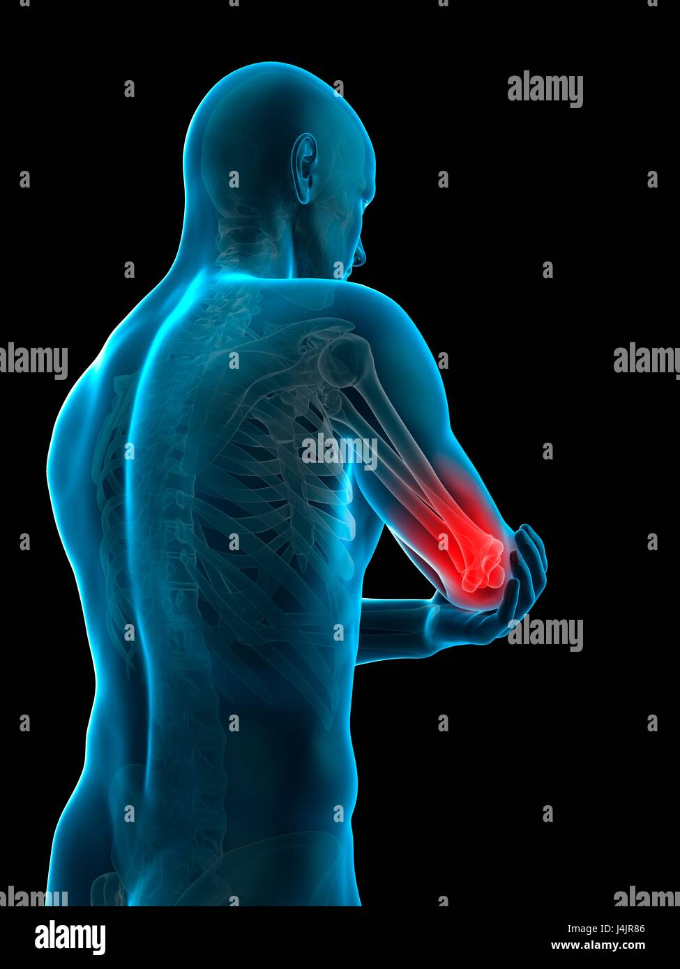 Human elbow pain, illustration Stock Photo - Alamy