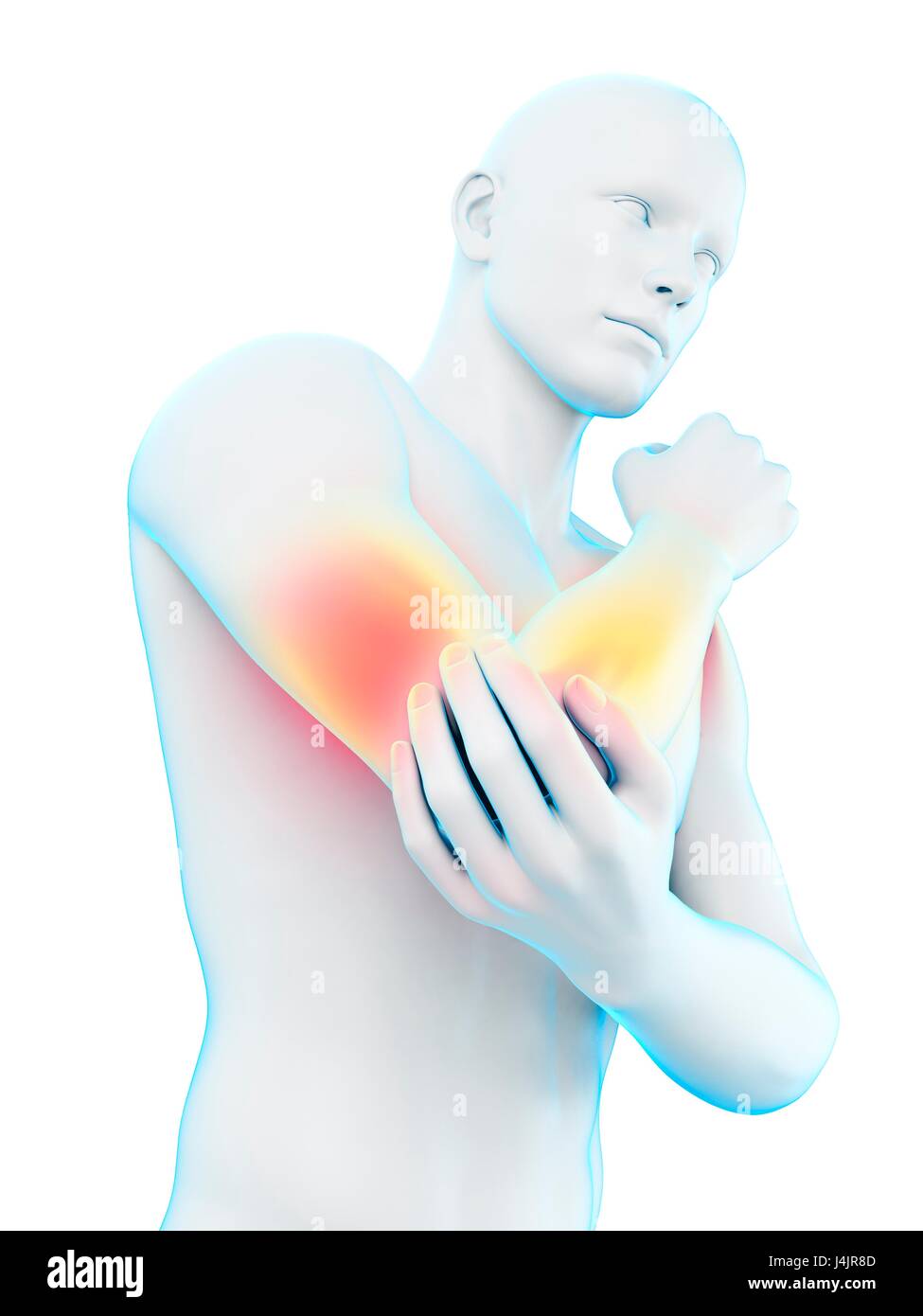 Human elbow pain, illustration Stock Photo - Alamy