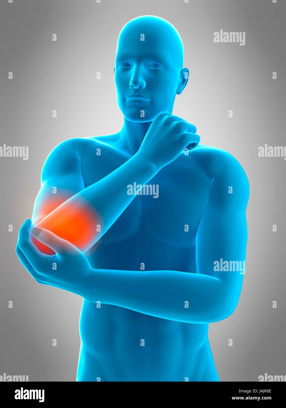 Human elbow pain, illustration Stock Photo - Alamy