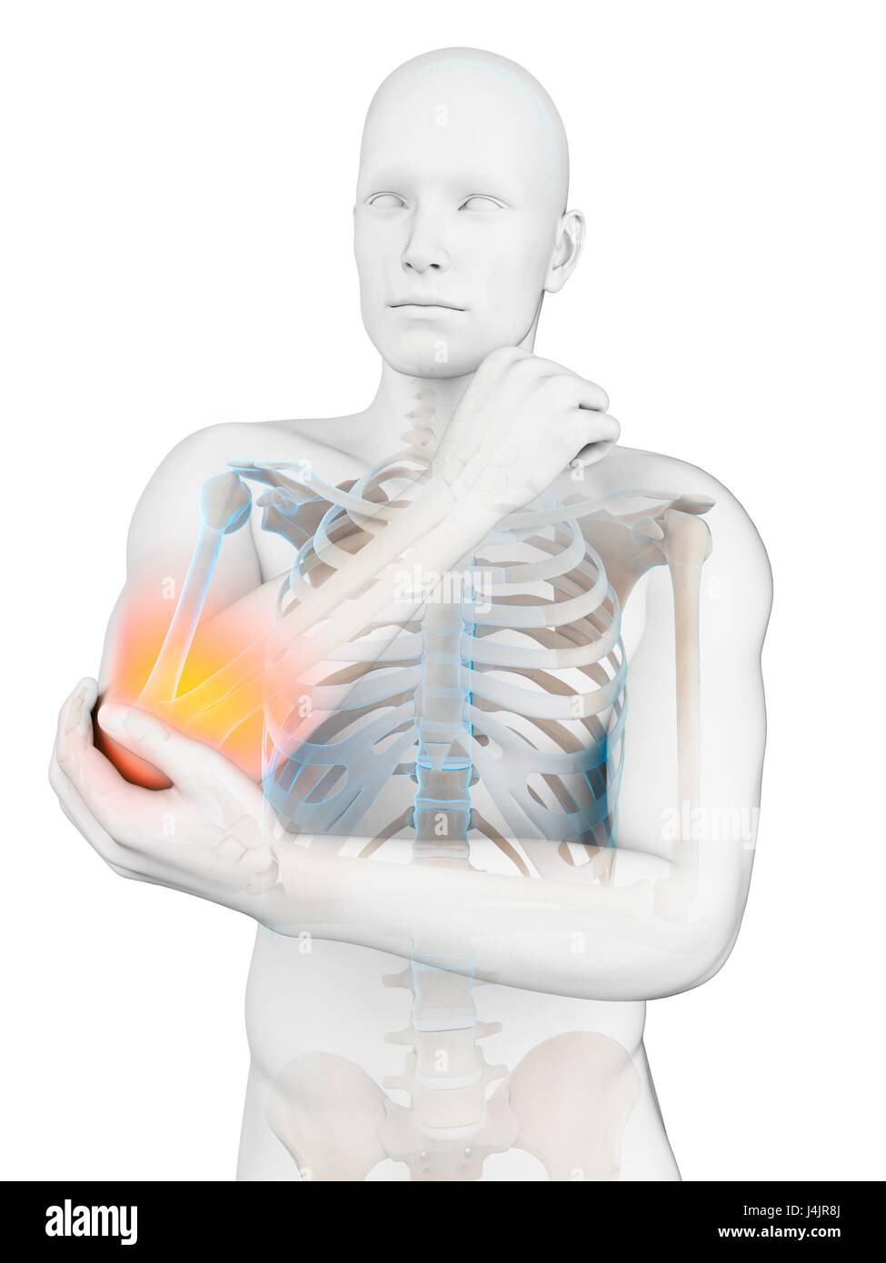 Human elbow pain, illustration Stock Photo - Alamy