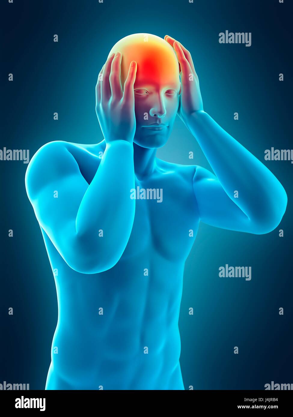 Person with headache, illustration Stock Photo - Alamy