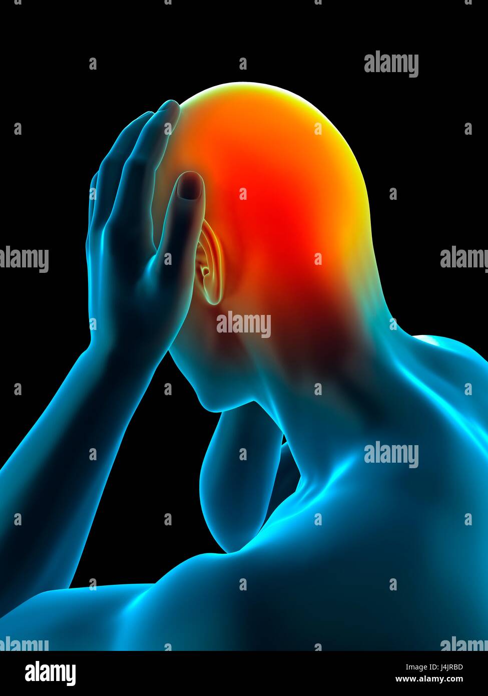 Person with headache, illustration Stock Photo - Alamy