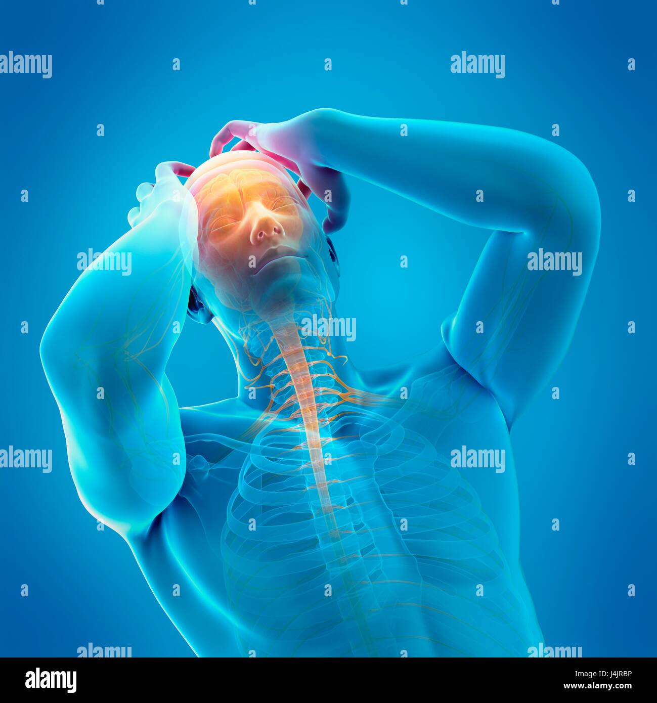 Person with headache, illustration Stock Photo - Alamy