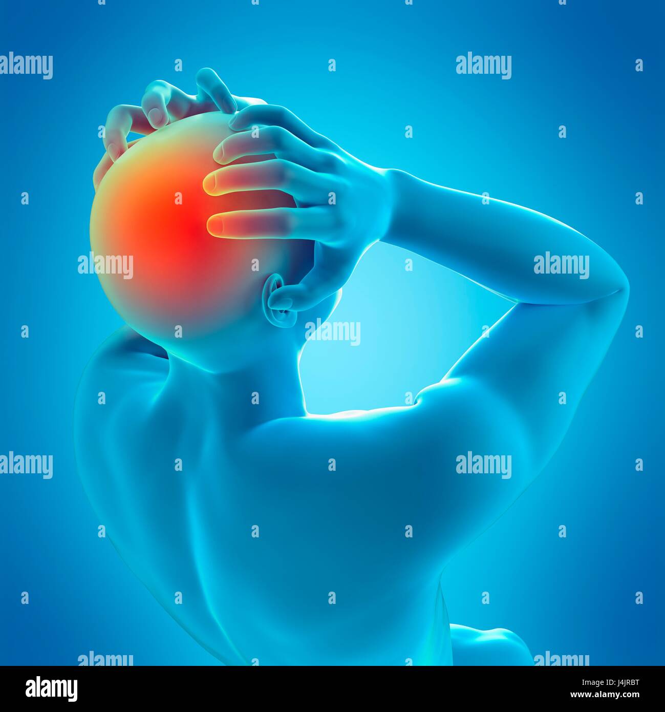 Person with headache, illustration Stock Photo - Alamy
