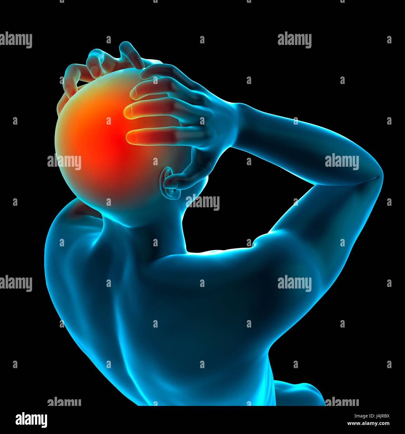 Person with headache, illustration Stock Photo - Alamy