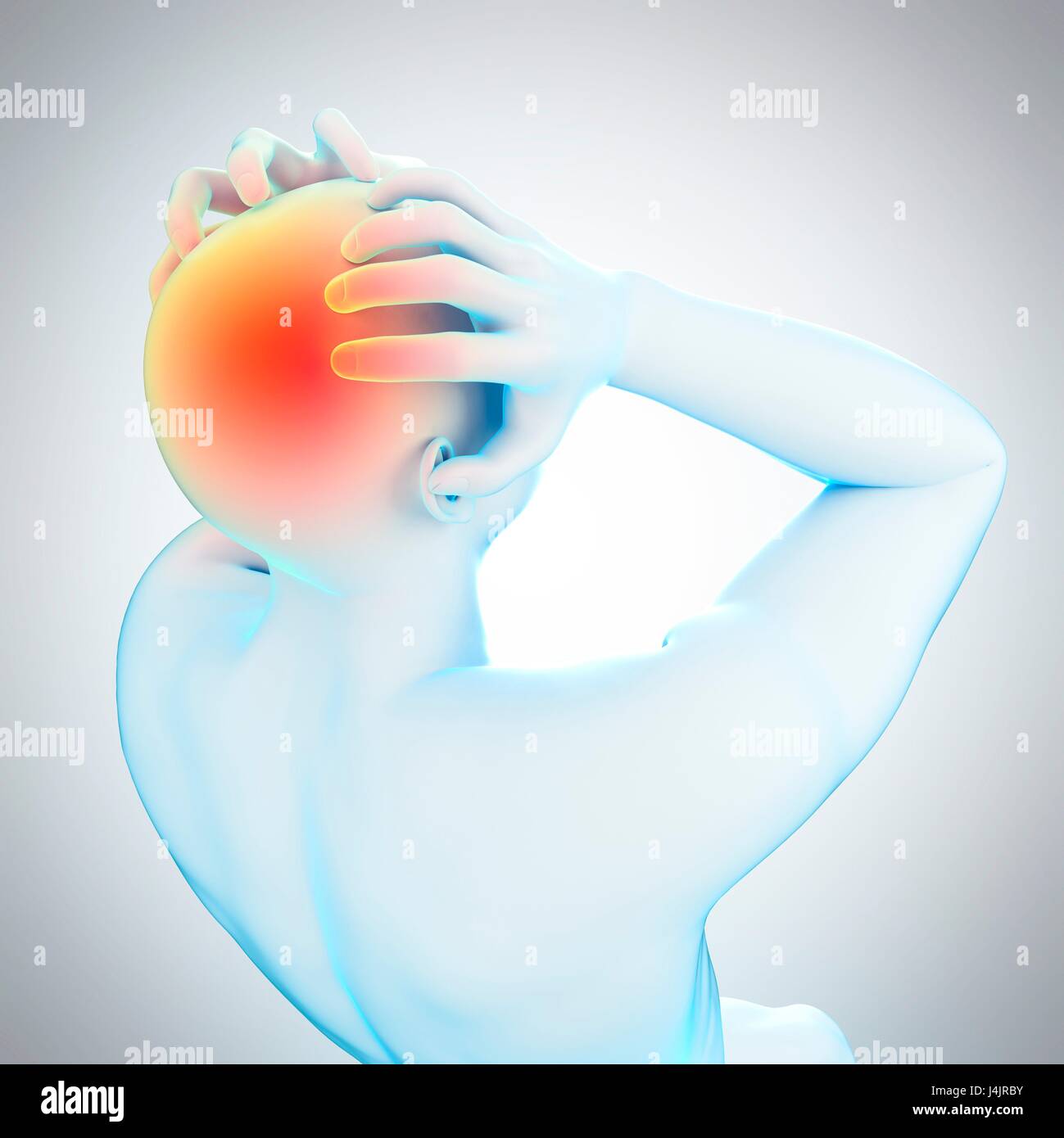 Person with headache, illustration Stock Photo - Alamy