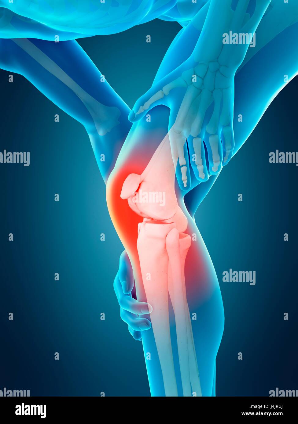 Human knee pain, illustration Stock Photo - Alamy