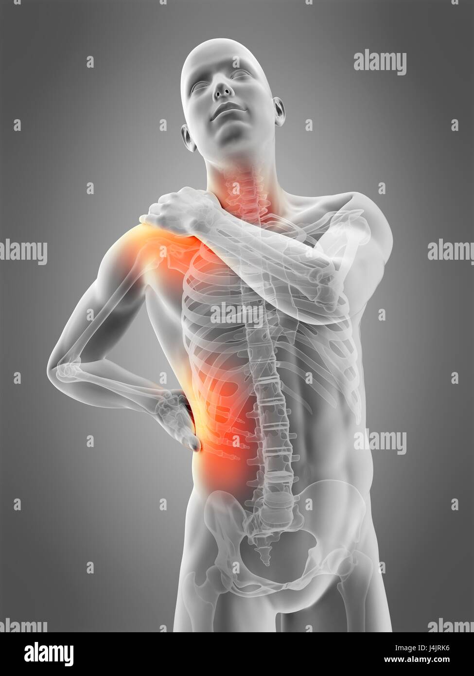 Skeletal structure of human shoulder and waist pain, illustration Stock ...