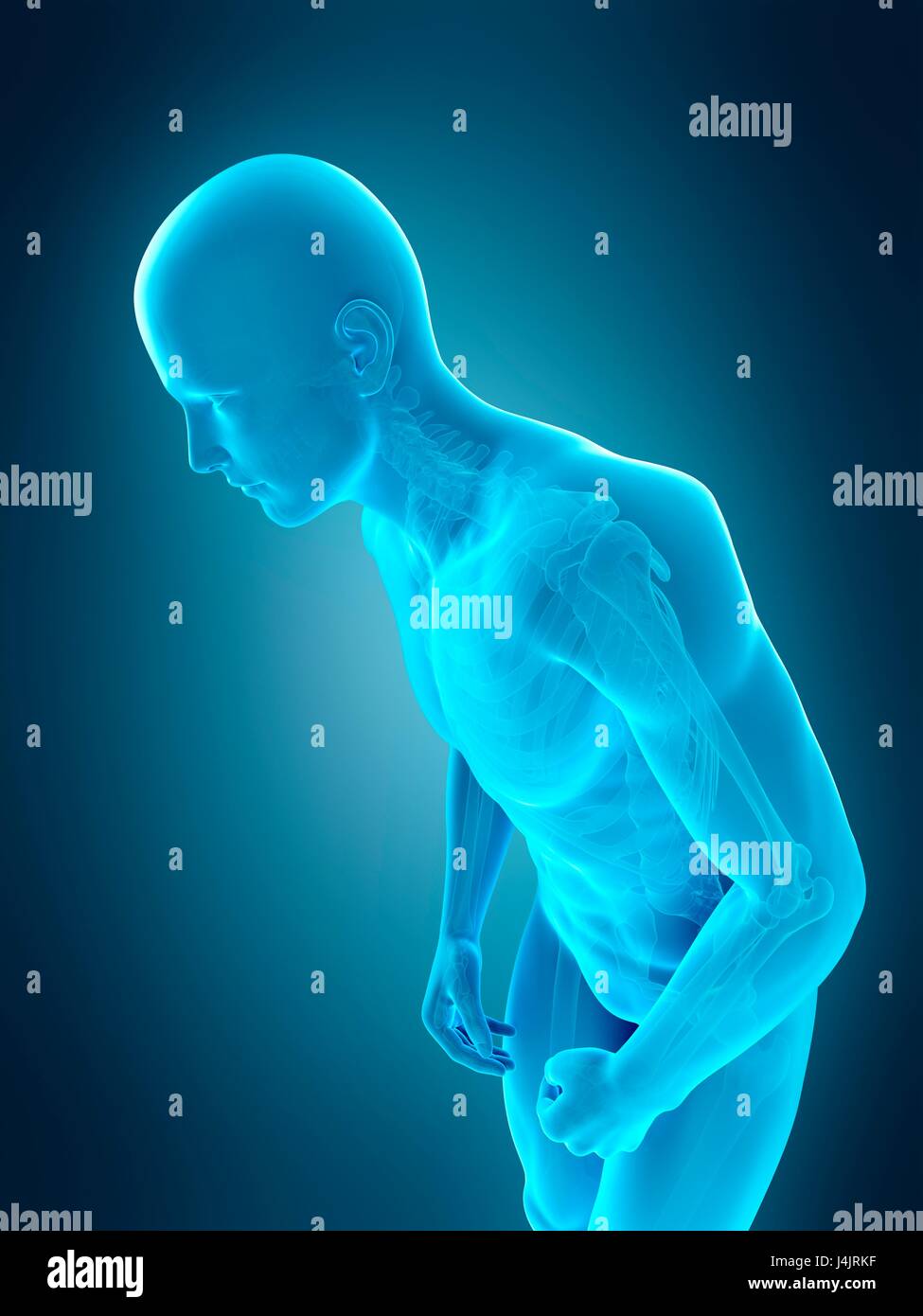 Person bending over, illustration Stock Photo - Alamy
