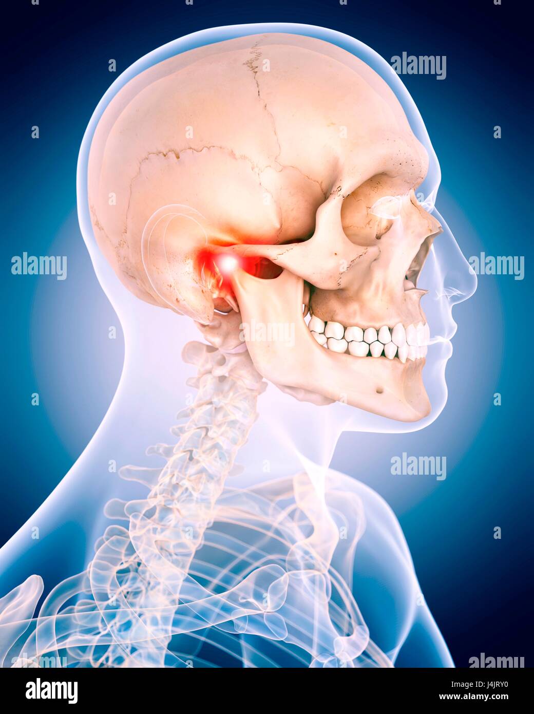 Human jaw pain, illustration Stock Photo - Alamy