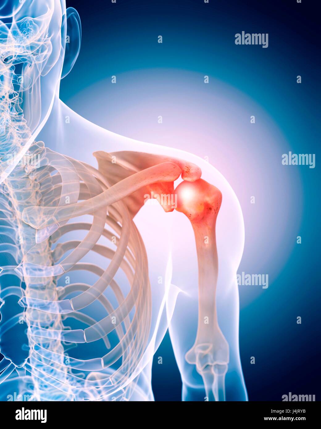 Human shoulder pain, illustration Stock Photo - Alamy