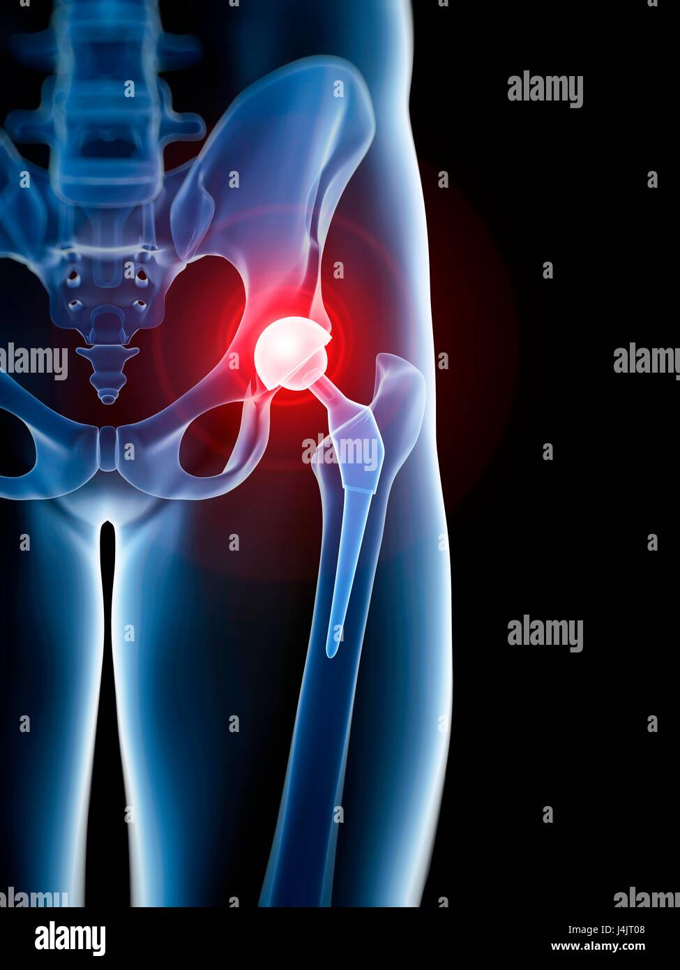 Human replacement hi-res stock photography and images - Alamy