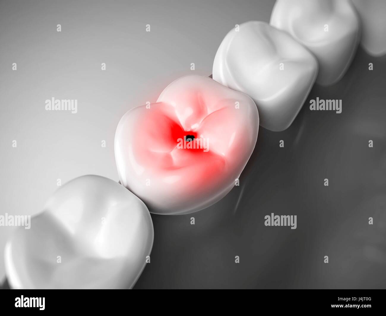 Human tooth pain, illustration Stock Photo - Alamy