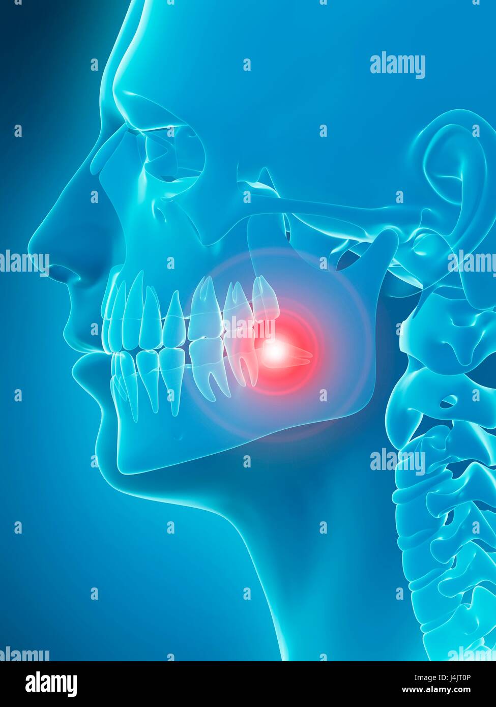 Human tooth pain, illustration Stock Photo - Alamy