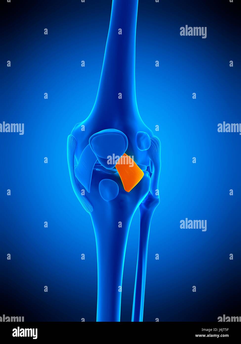Lateral patellar ligament hi-res stock photography and images - Alamy