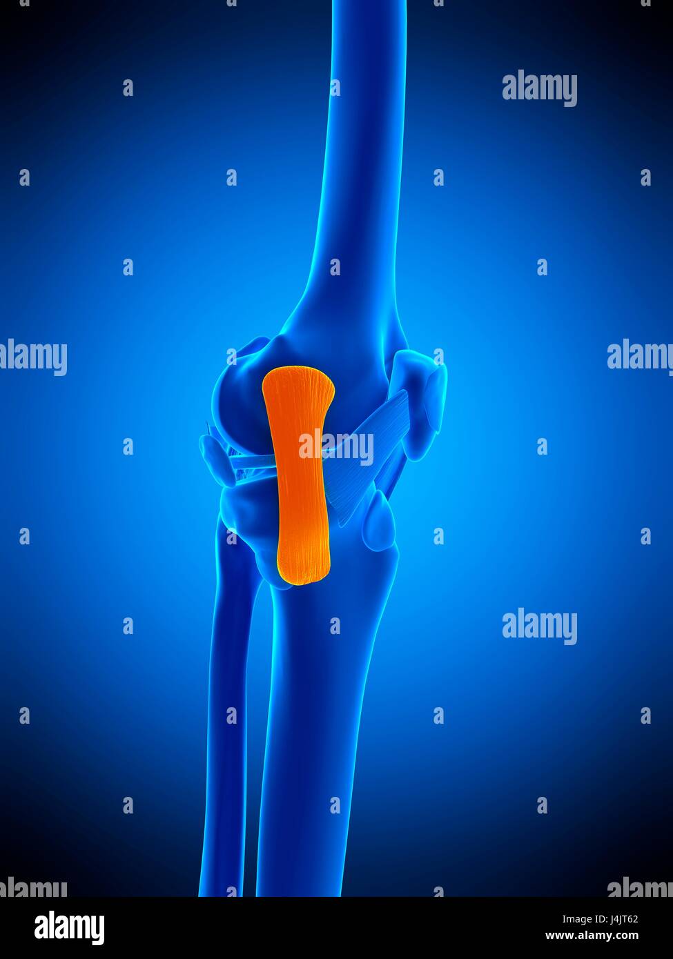 Tibial Collateral Ligament