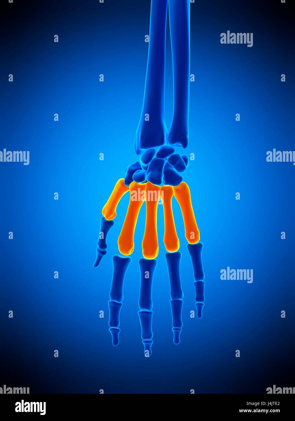 Illustration of the metacarpals bones Stock Photo - Alamy