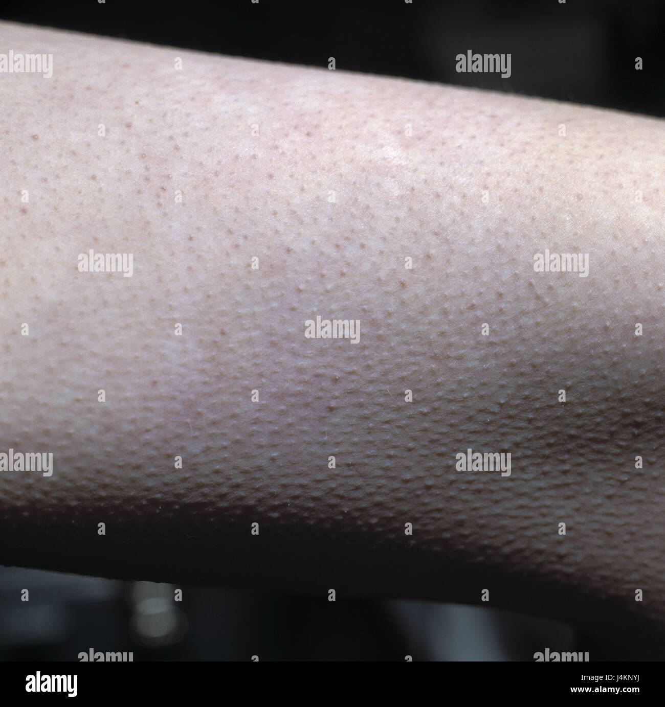 Arm, goose flesh, detail body, shell, reaction, stimulus, shell ...