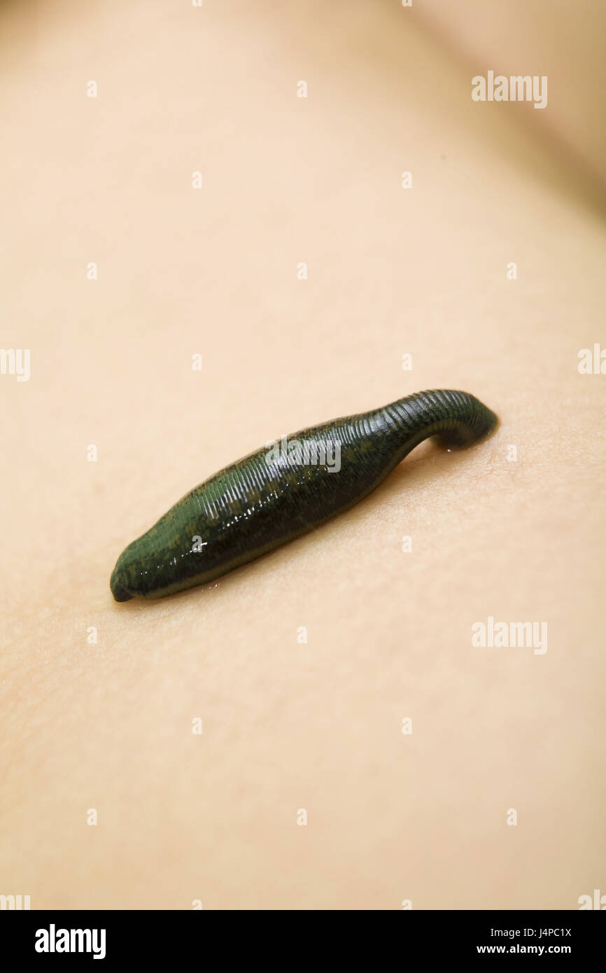 Treatment with leech, Hirudotherapy Stock Photo - Alamy