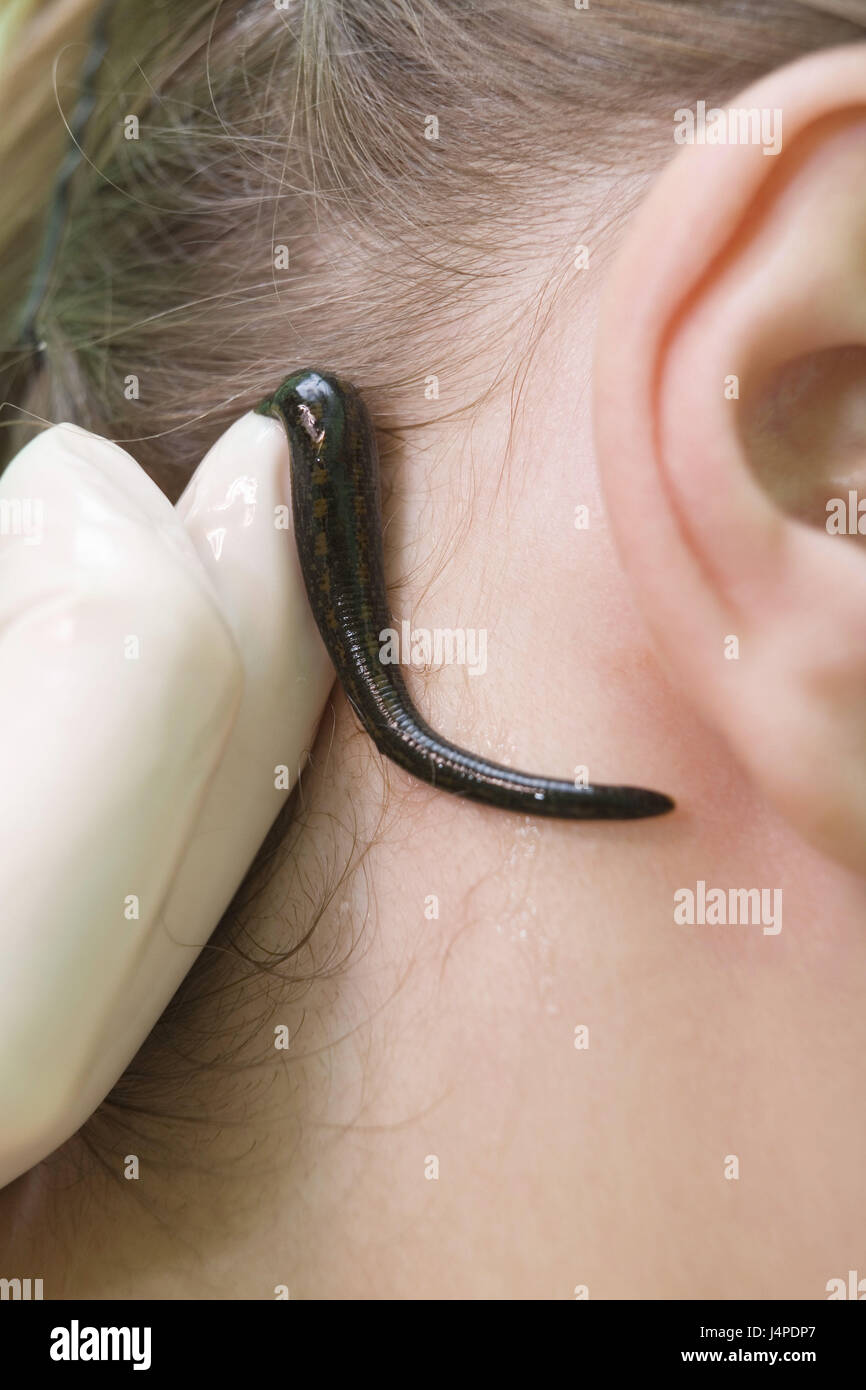 Ear suction hi-res stock photography and images - Alamy