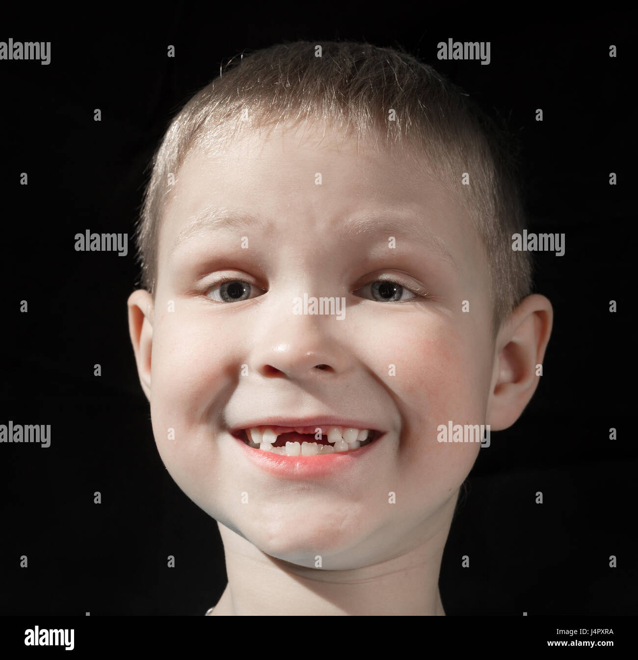 Boy with front teeth missing hi-res stock photography and images - Alamy
