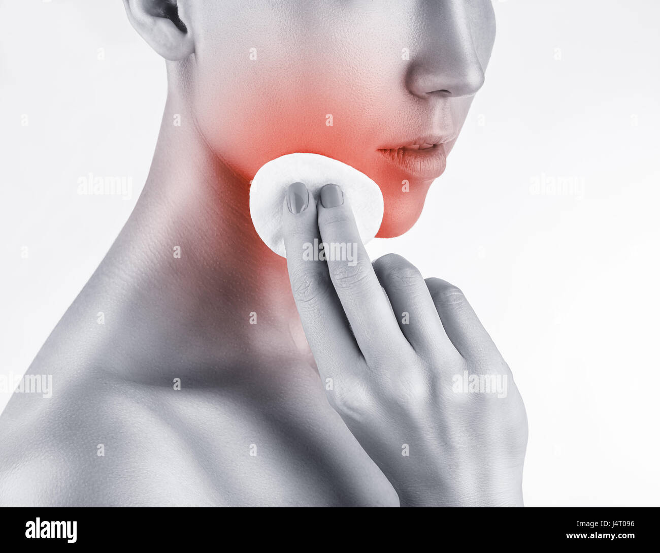 Young woman struggling with acne on the face with a cotton pad isolated ...