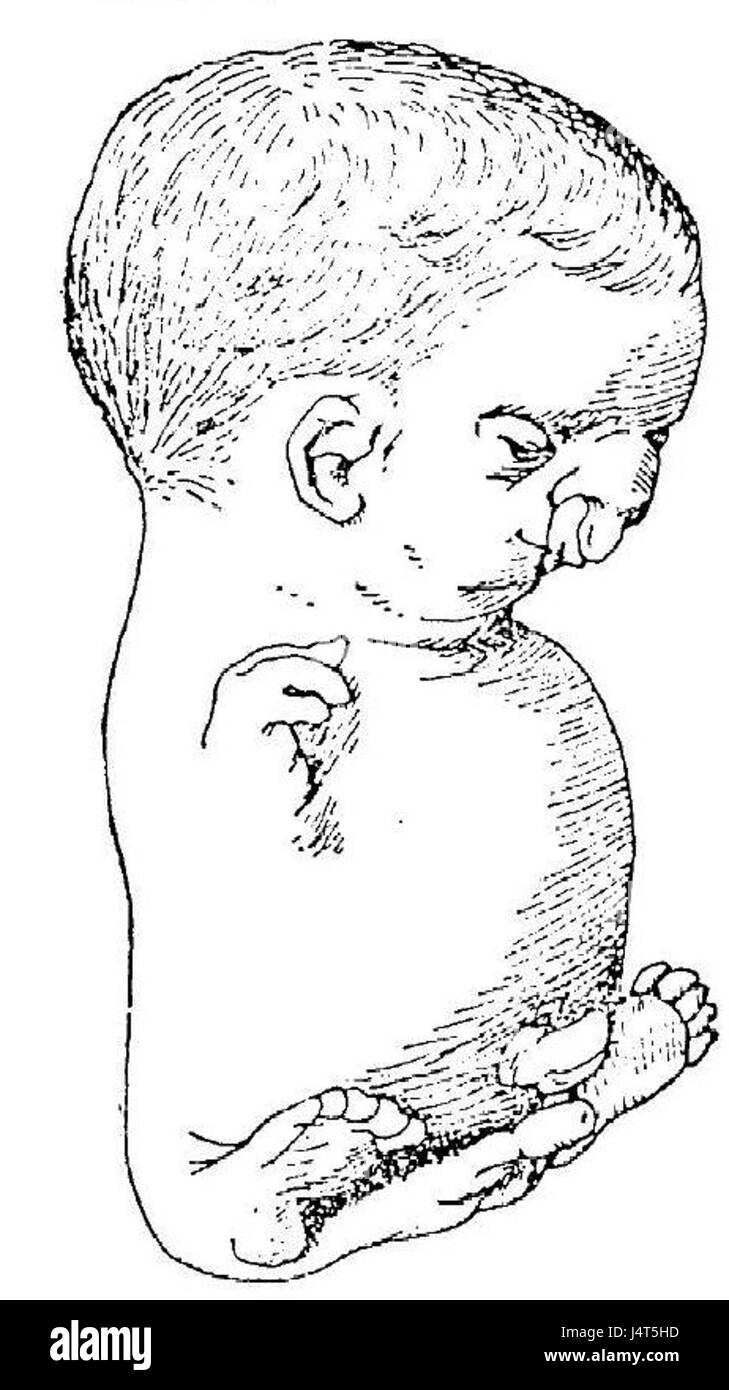 History of the fetus hi-res stock photography and images - Alamy