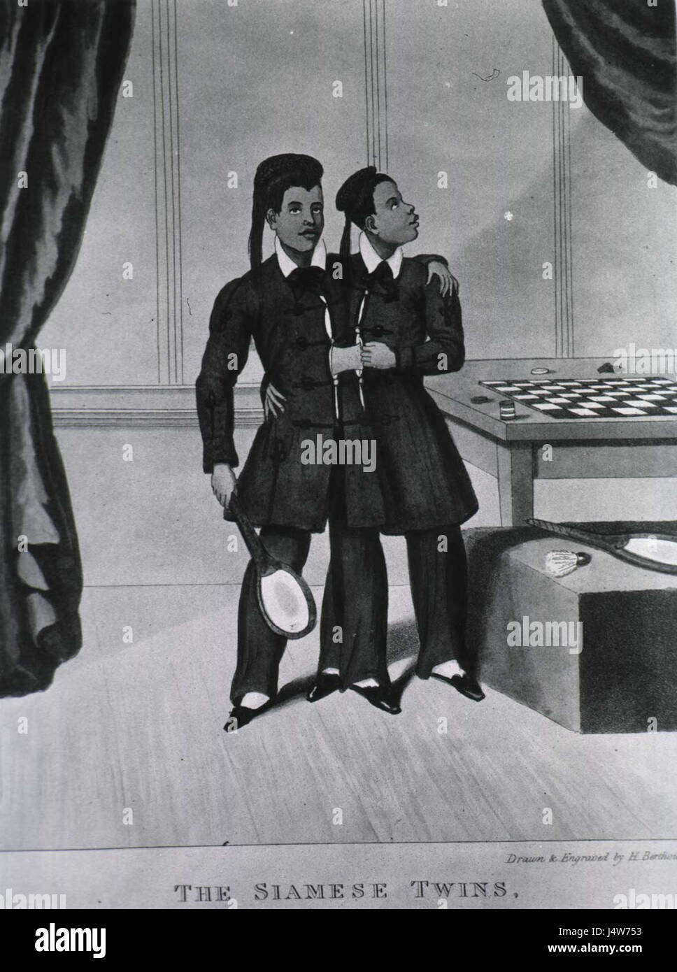 The Siamese Twins, Chang and Eng Bunker, were famous conjoined twins who gained widespread ...