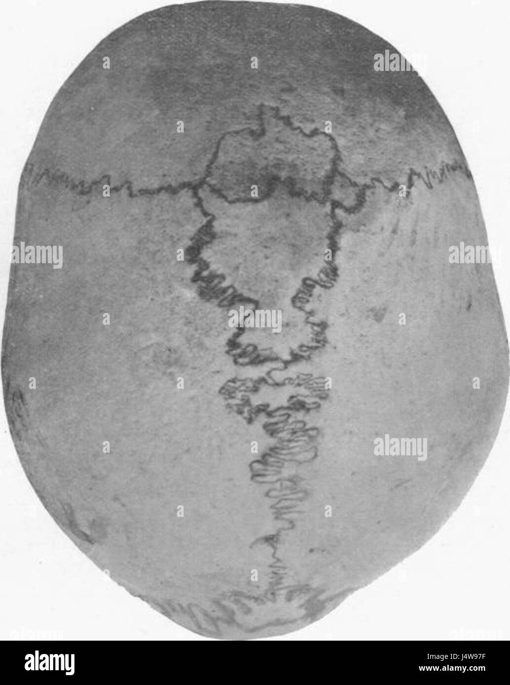 Wormian hi-res stock photography and images - Alamy