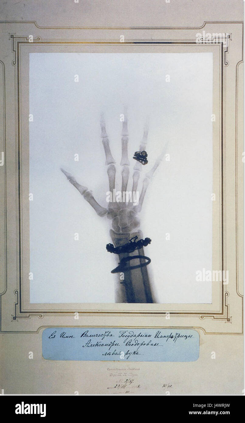 This X-ray image of Alexandra, Empress of Russia's hand and wrist ...