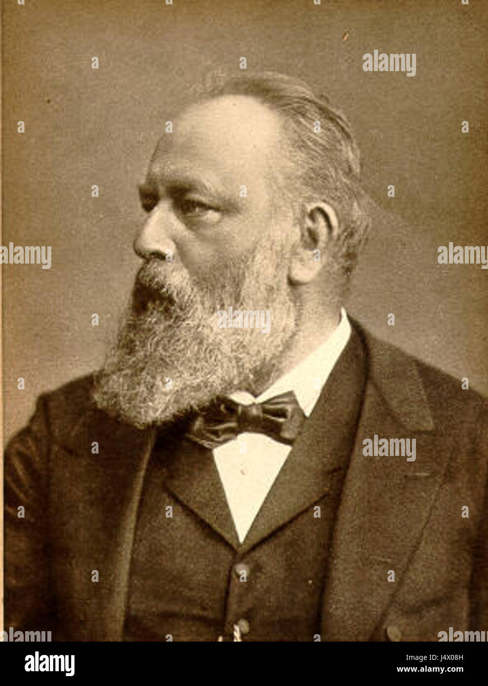 Theodor Billroth was a pioneering surgeon known for his contributions ...