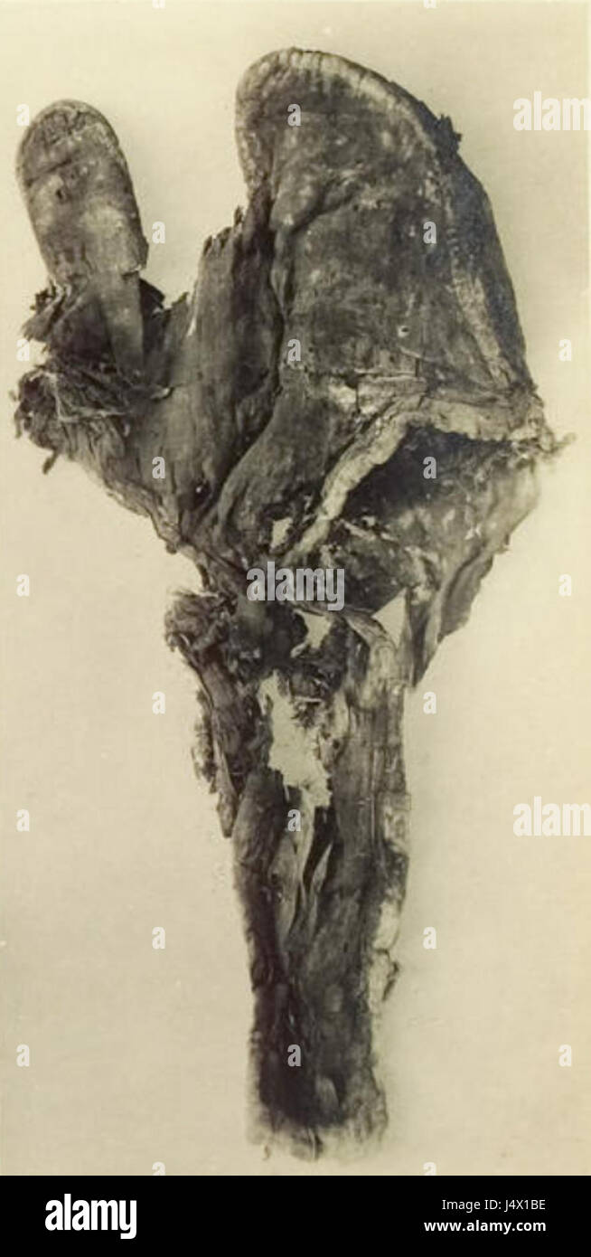 These photographs depict artifacts and scenes from the tomb of the ...