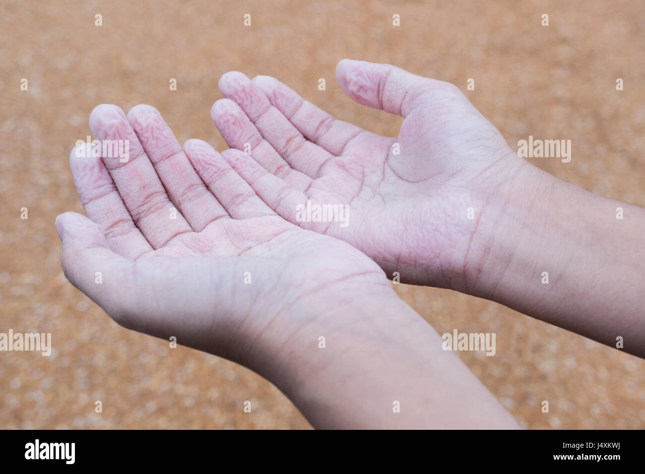 Skin hands hi-res stock photography and images - Alamy