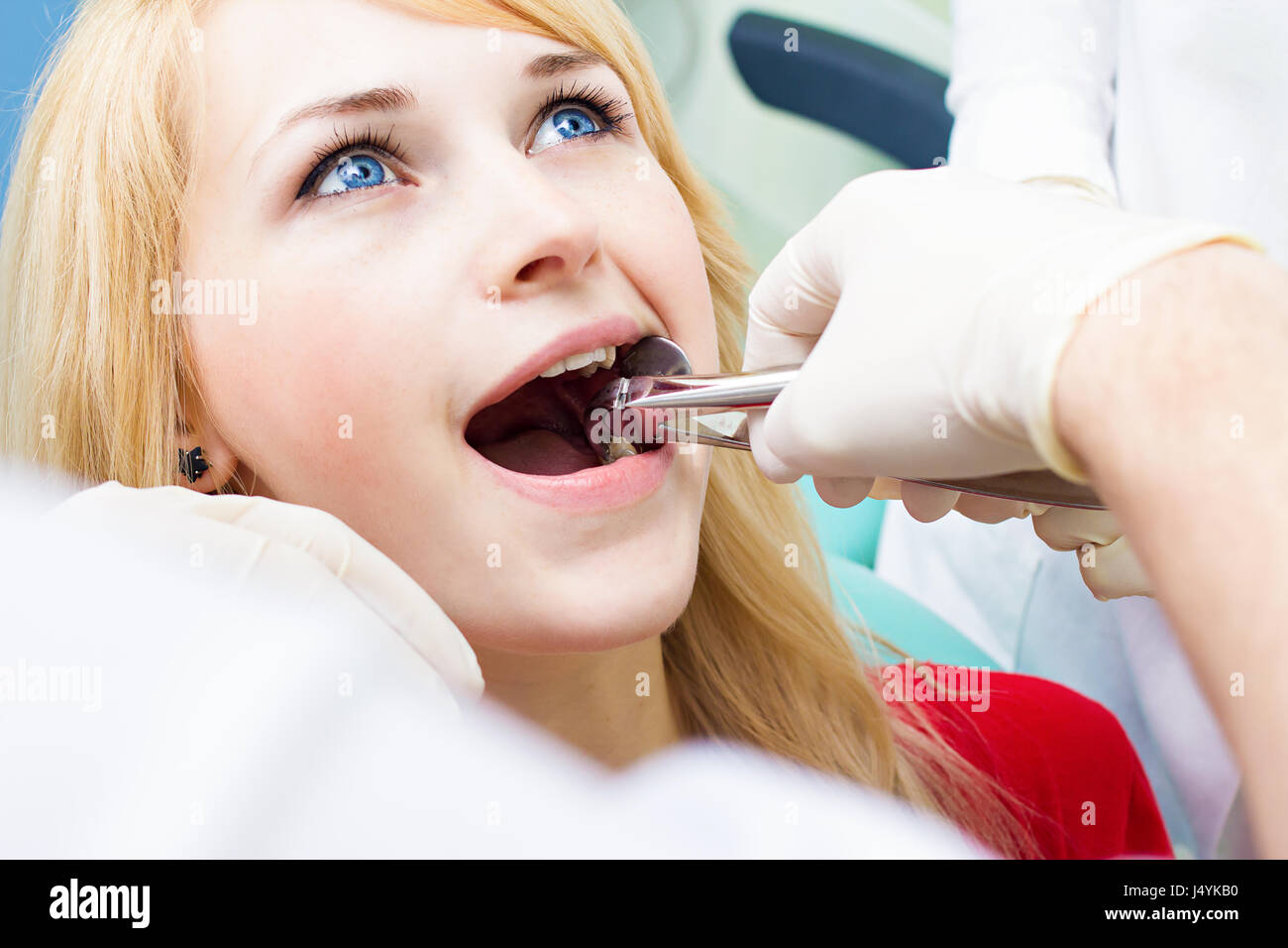 Dentist woman extraction hi-res stock photography and images - Alamy