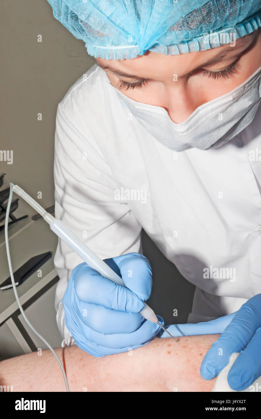 Electrocoagulation hi-res stock photography and images - Alamy