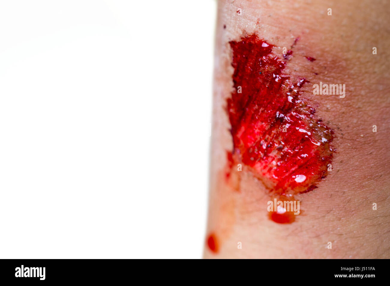 Bleeding wound hi-res stock photography and images - Alamy