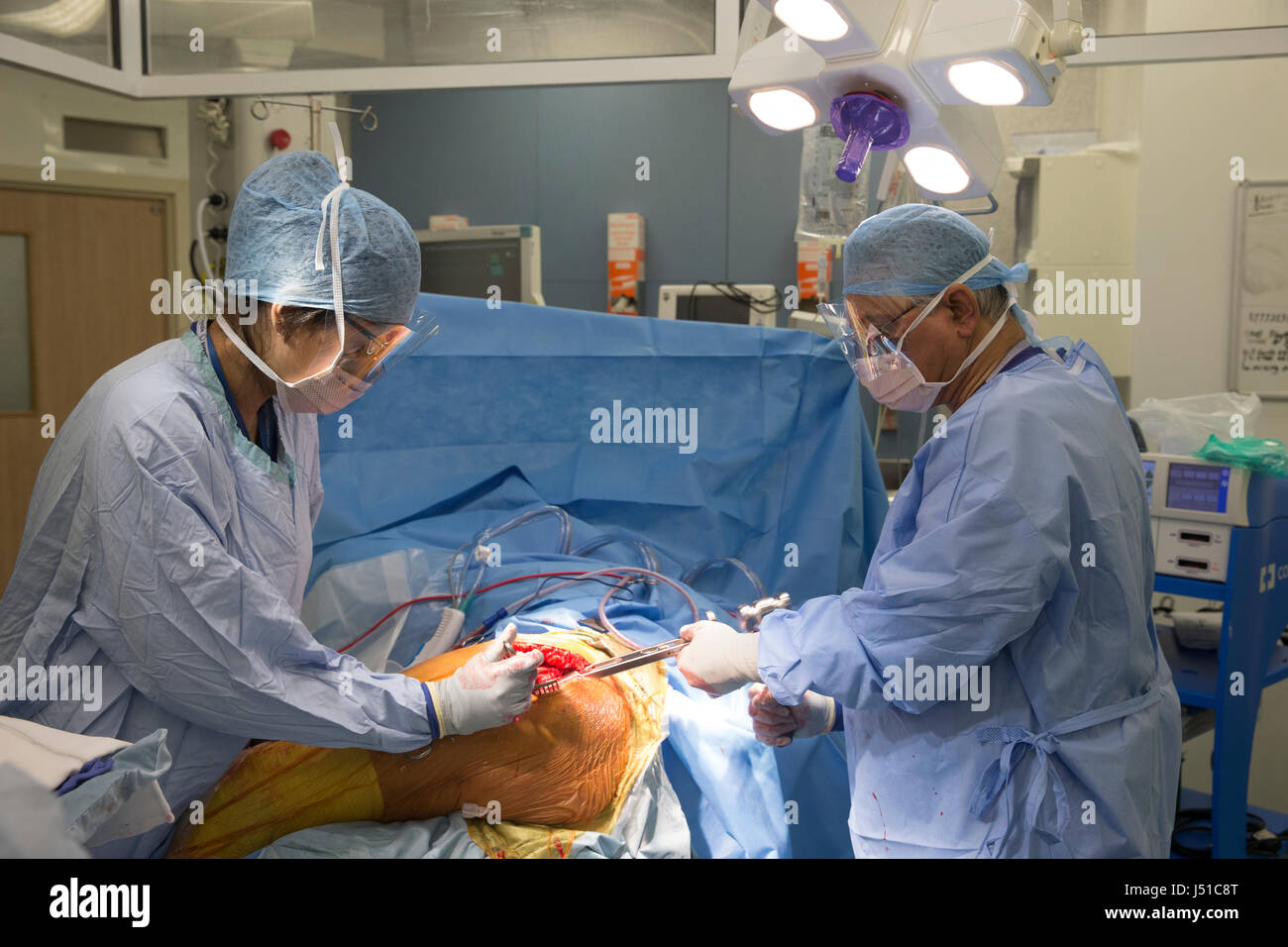 In labour in operating theatre hi-res stock photography and images - Alamy