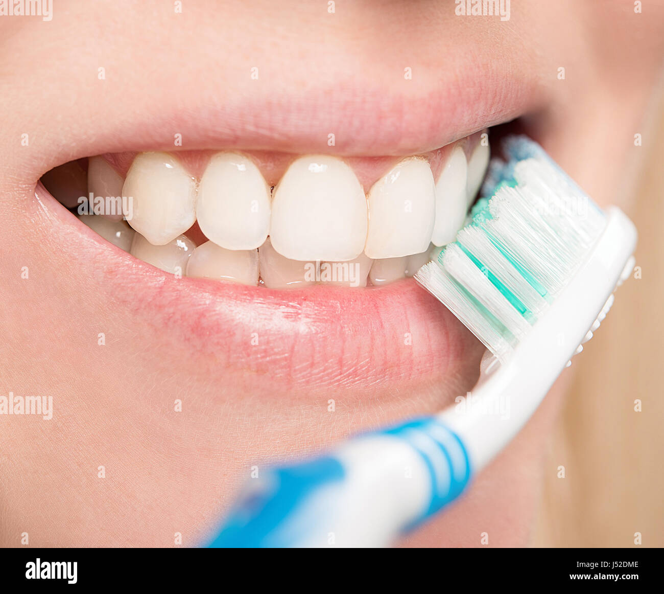 bleaching straight beautiful teeth Stock Photo - Alamy