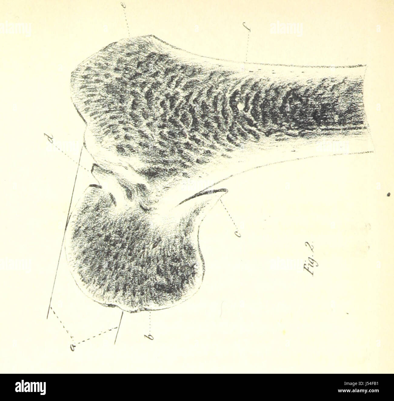 Practical Remarks on the Nature and Treatment of Fractures of the Trunk ...