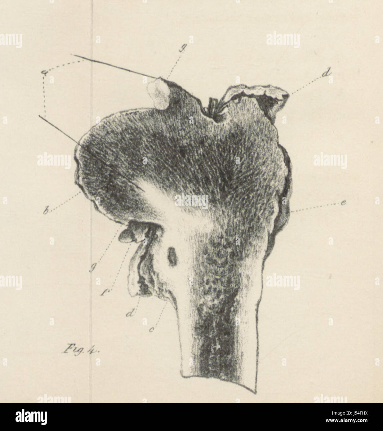 Practical Remarks on the Nature and Treatment of Fractures of the Trunk ...