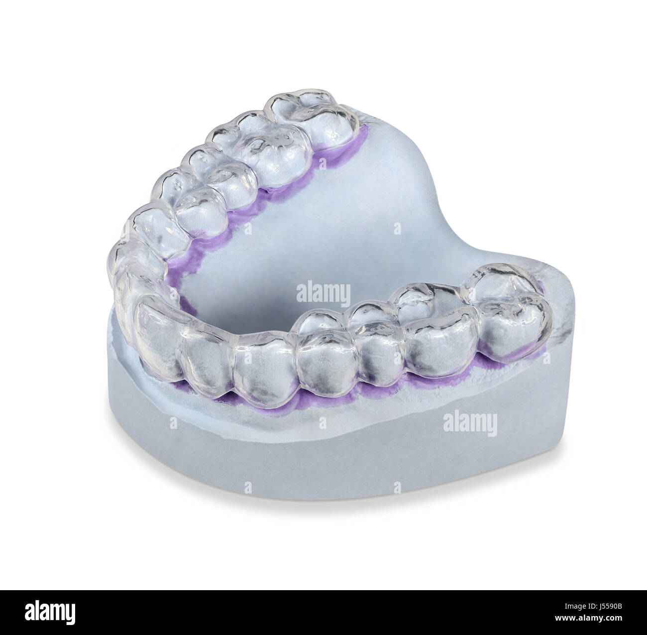 Dental splint hi-res stock photography and images - Alamy