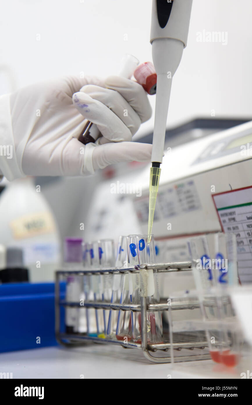 Research with a pipette in the lab. A close look at the testing of ...