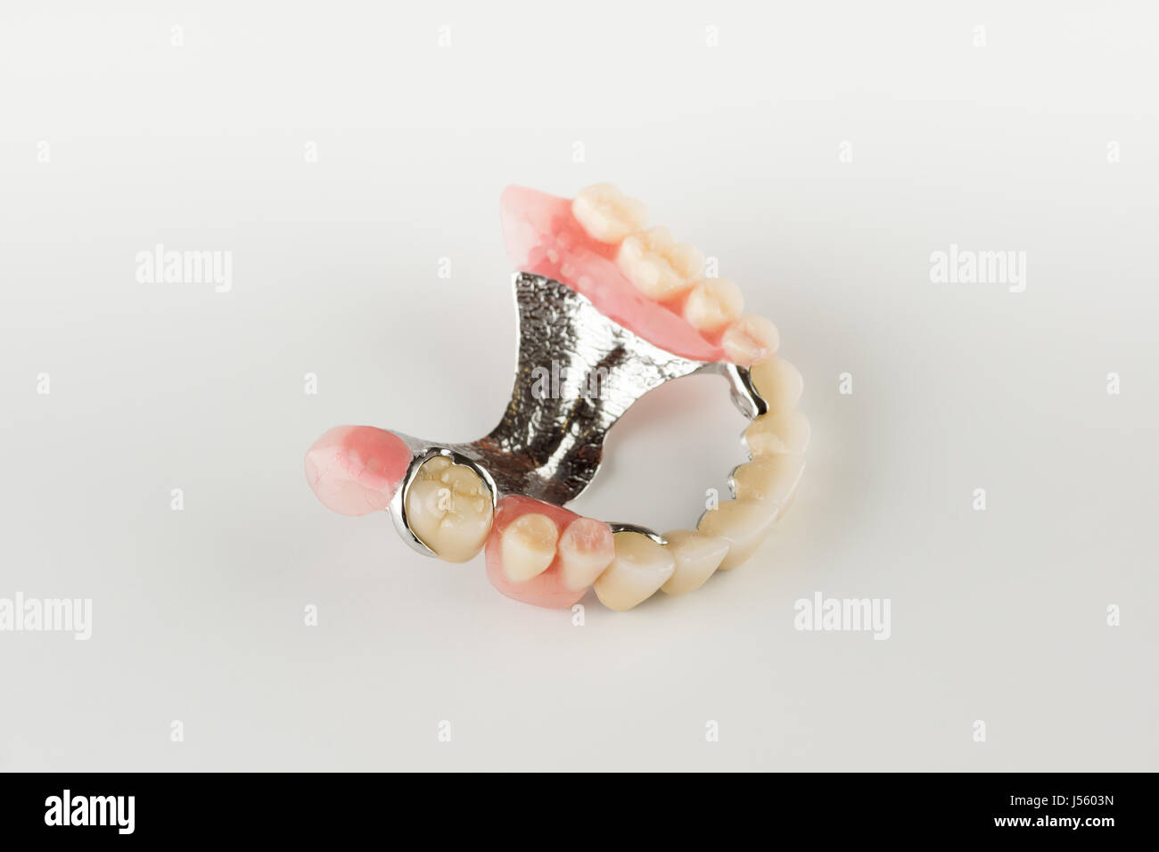 Clasp prosthesis with lock fixation on a white background Stock Photo ...