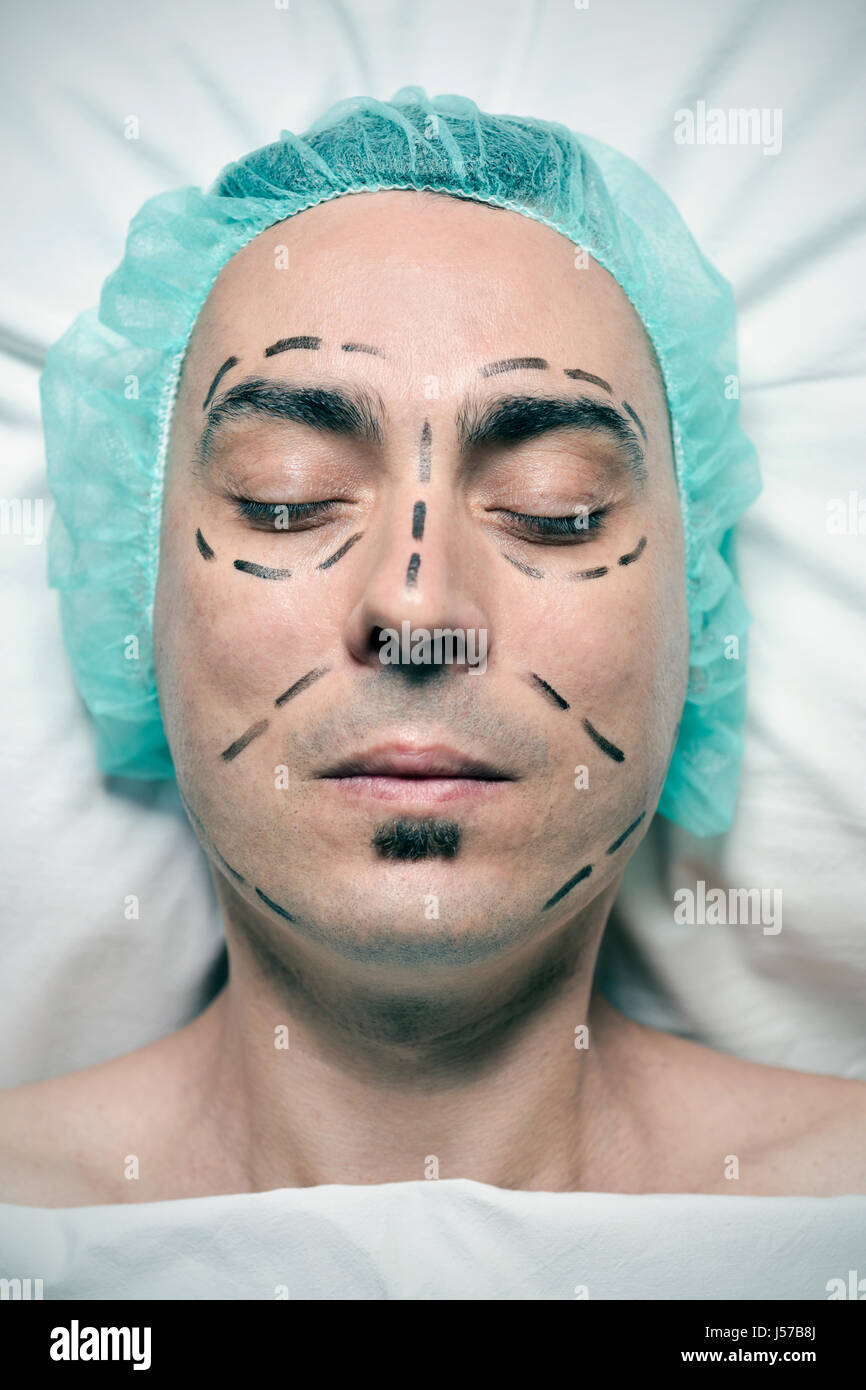 Man face surgery marks hi-res stock photography and images - Alamy