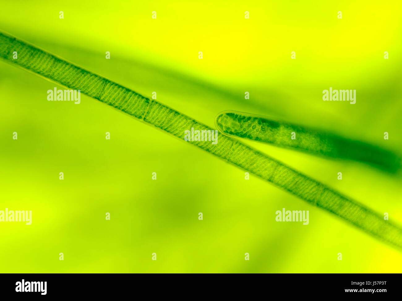Microscopic view of green algae (Spirogyra). Rheinberg illumination ...